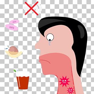 Streptococcal Pharyngitis PNG Images, Streptococcal Pharyngitis Clipart ...